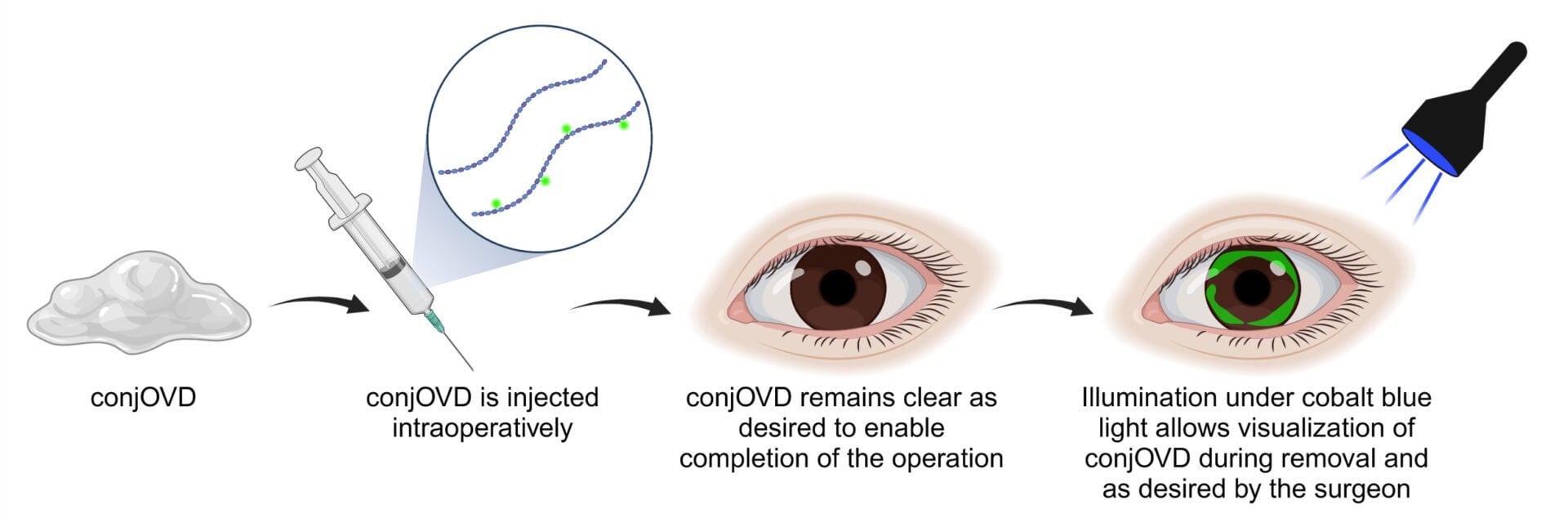 Scientists engineer 'glowing' gel to improve eye surgery - Johns ...